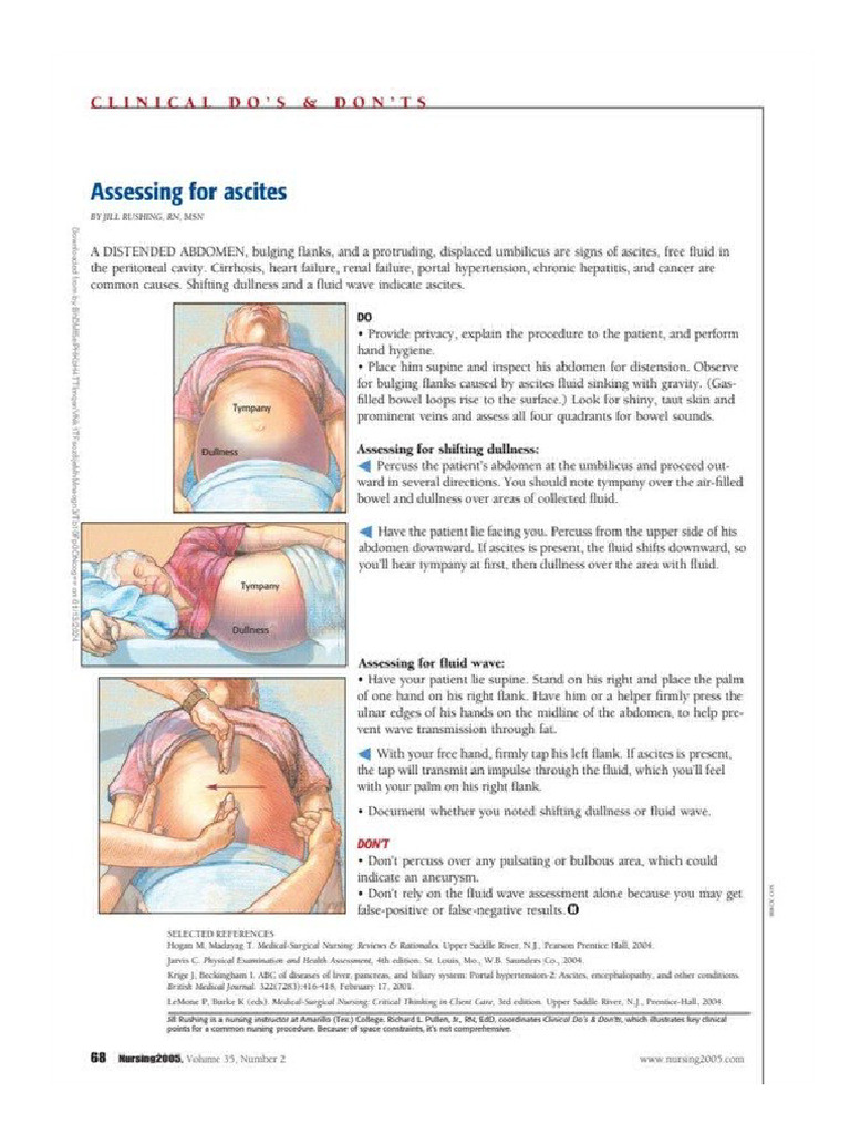 ascites notes rltd | PDF