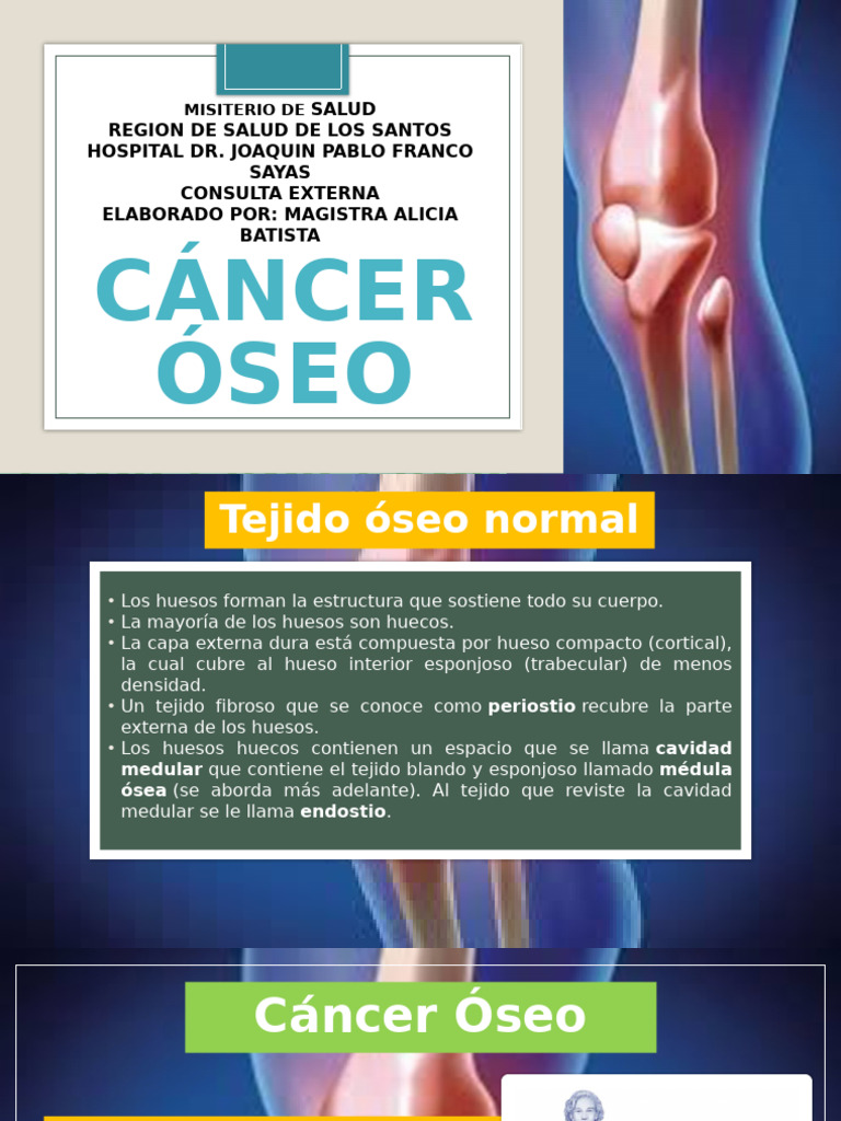 Cáncer Óseo | PDF