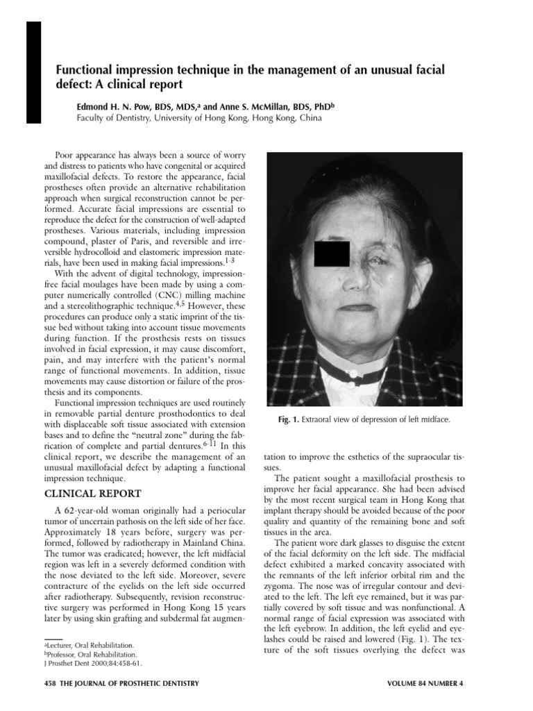 Orbital Prosthesis 2 | PDF