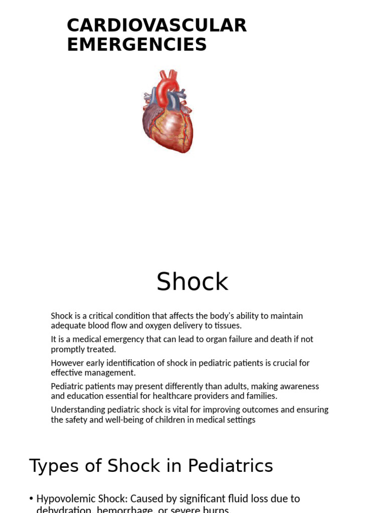 Shock | PDF