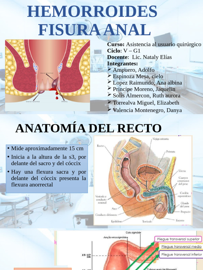 Hemorroides Fisura Anal | PDF