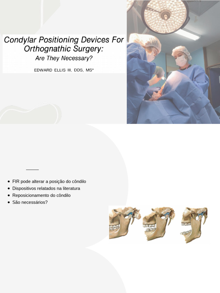 Aula Condylar Positioning | PDF