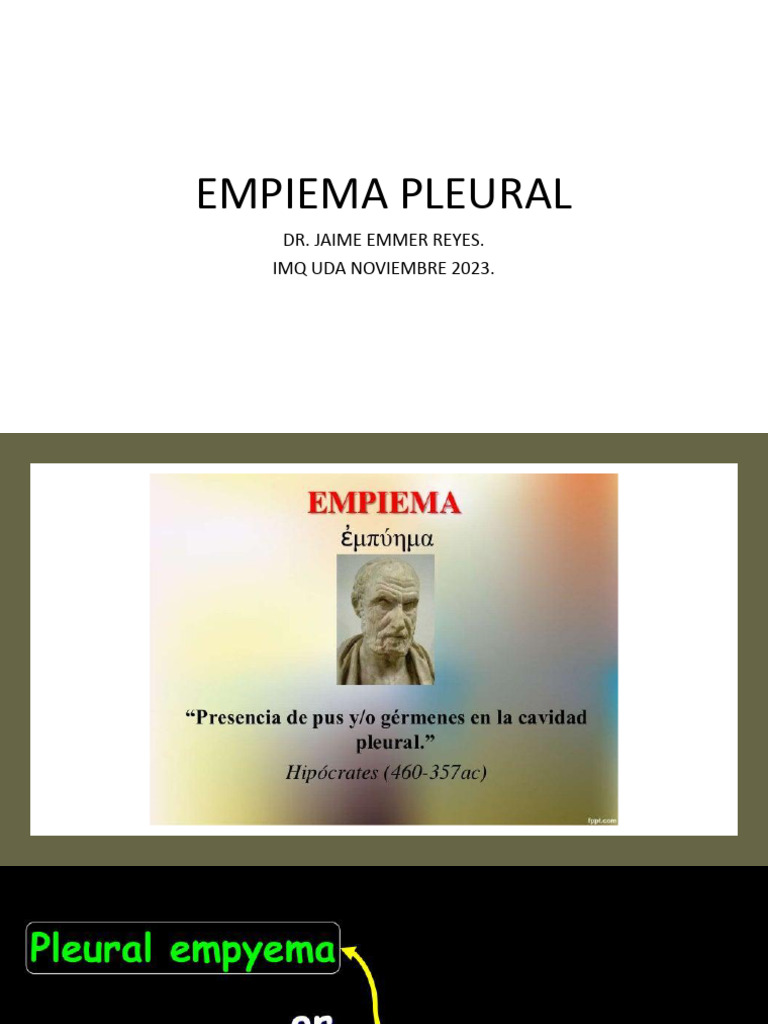 Empiema Pleural | PDF