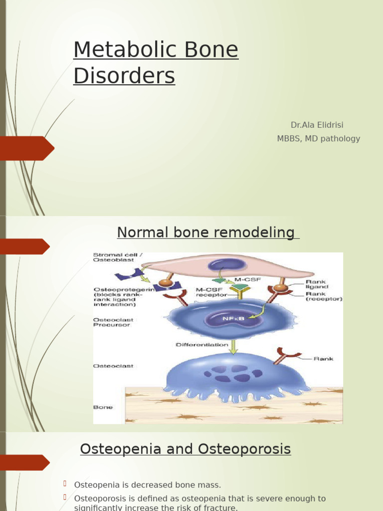 Metabolic Bone Disorders | PDF | Osteoporosis | Bone
