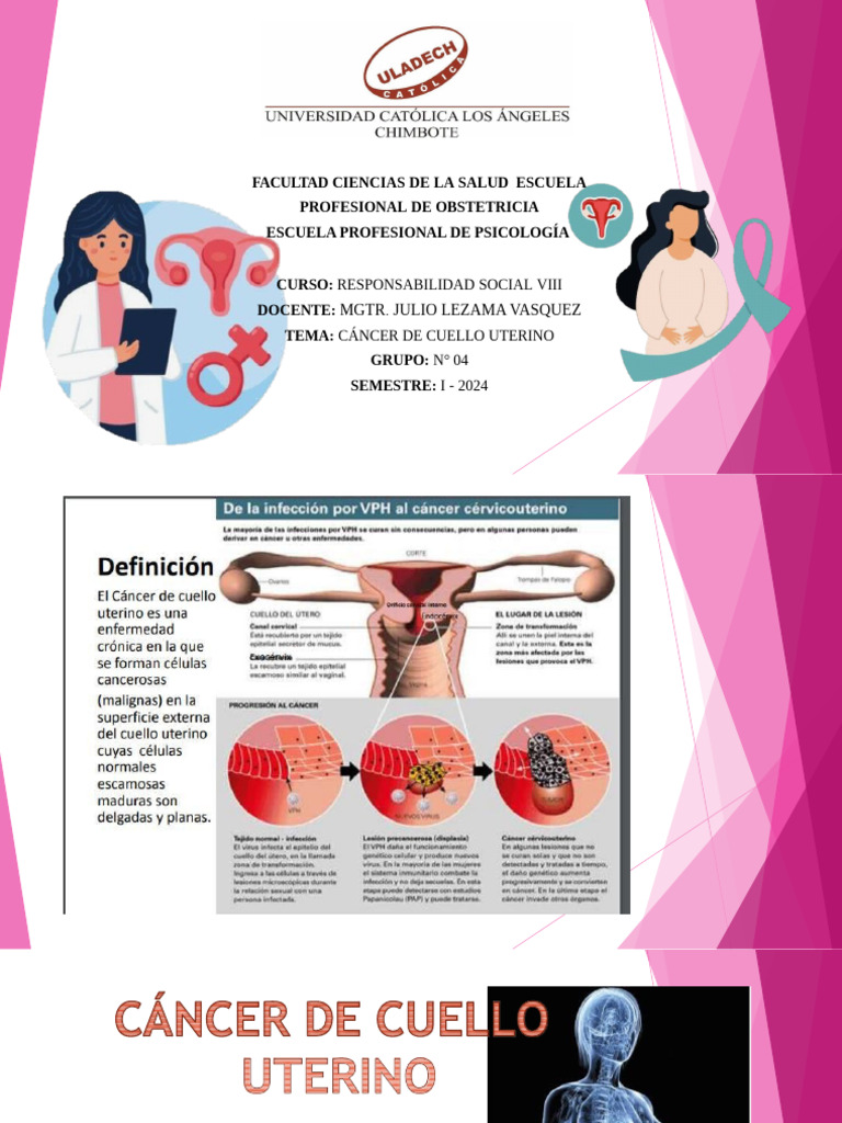 Cáncer de Cuello Uterino | PDF