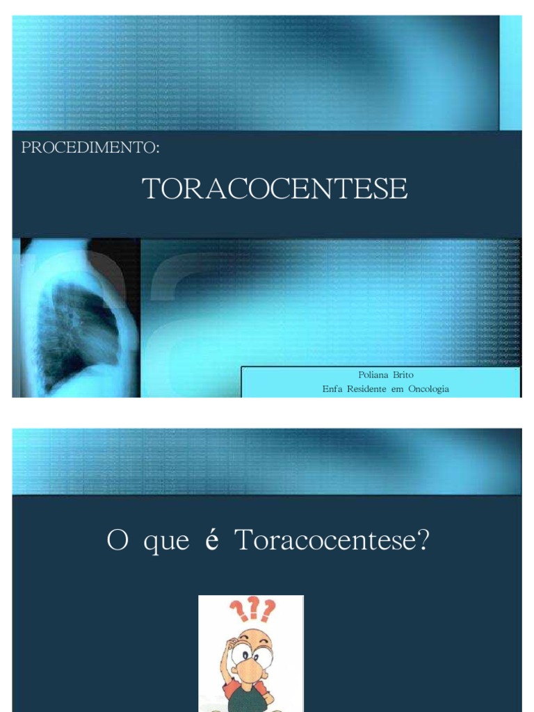 TORACOCENTESE | PDF | Especialidades médicas | Medicina Clínica