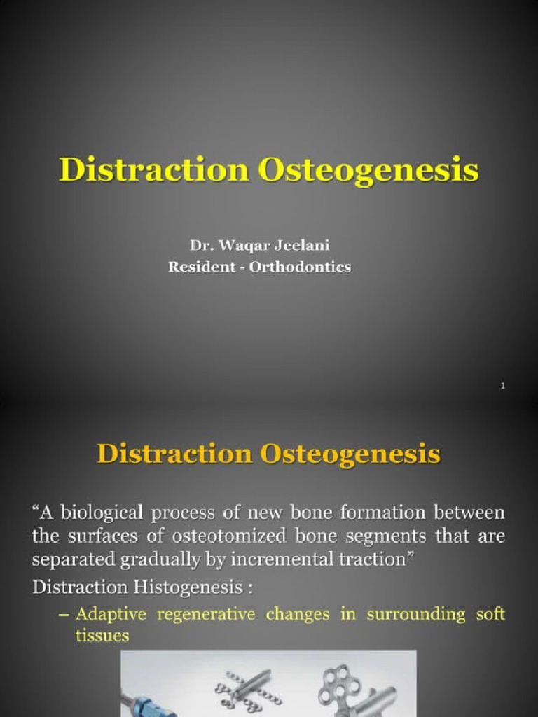 Distraction Osteogenesis | PDF