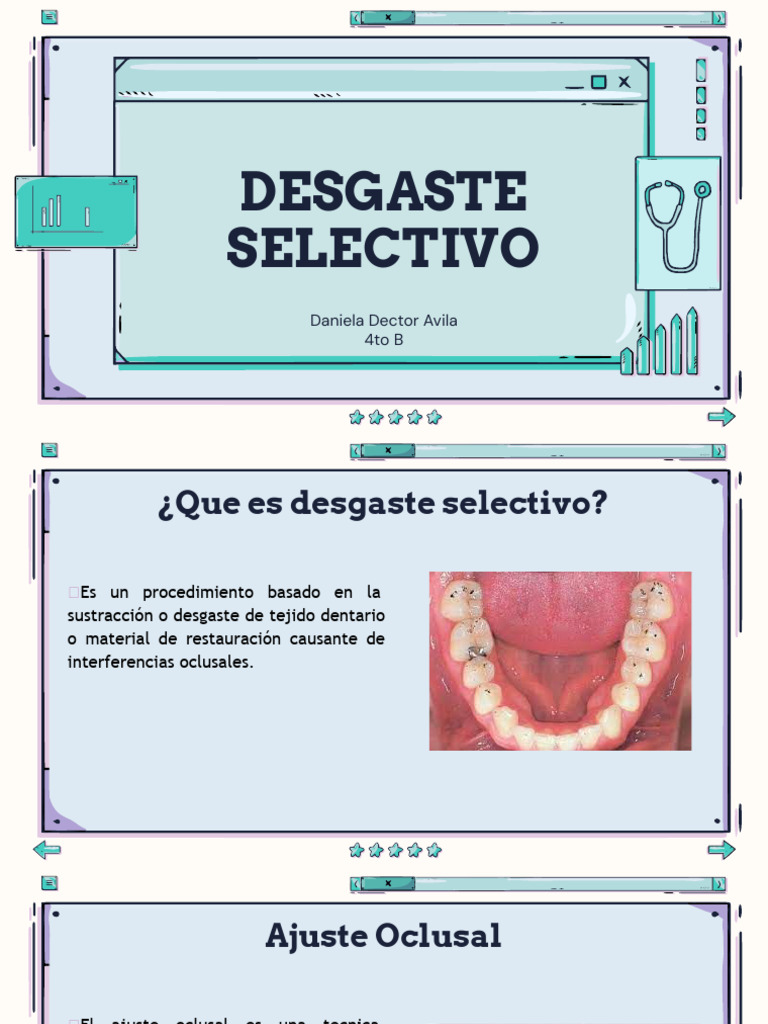 Desgaste Selectivo | PDF