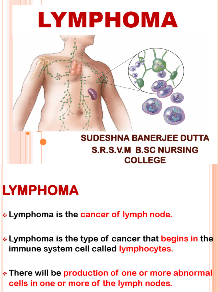 Lymphoma Converted2 200427063415 Pdf