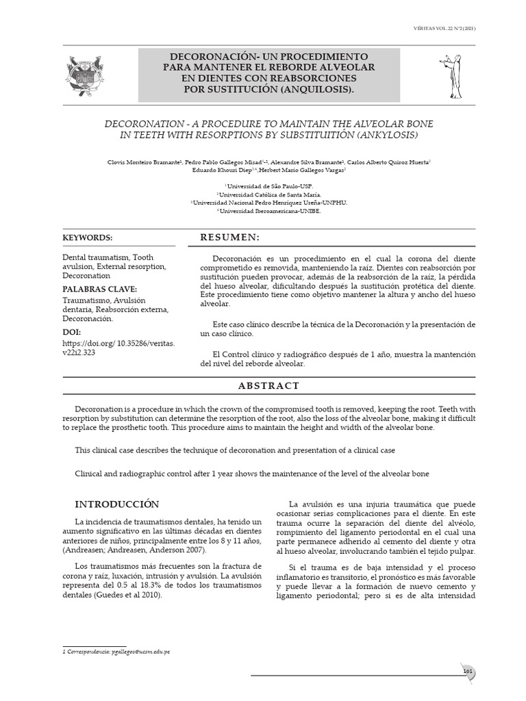 Decoronation - A Procedure To Maintain The Alveolar Bone in Teeth With ...