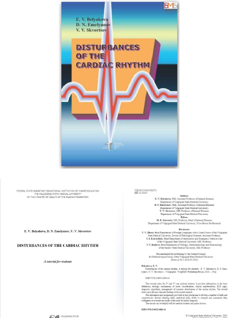 Disturbance of Cardiac Rhythm | PDF