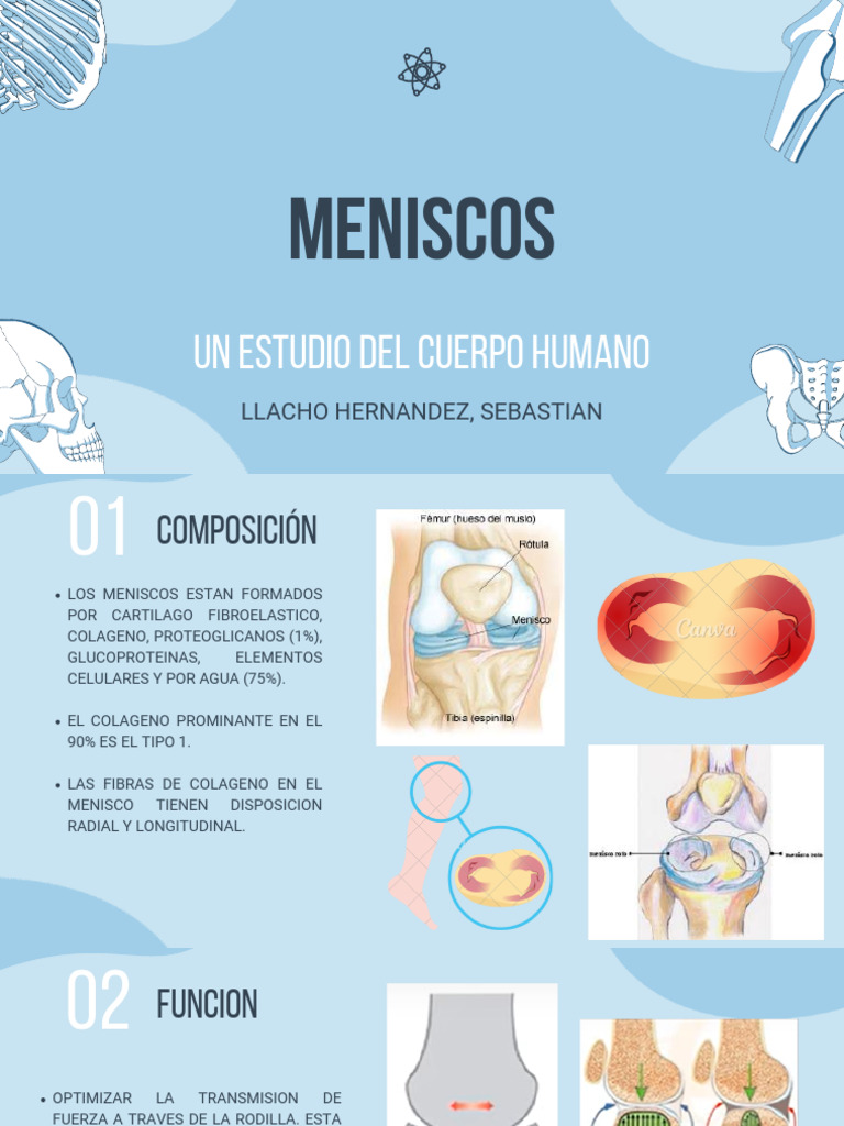 Lesion de Meniscos | PDF