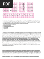 Atrial Fibrillation:Flutter in Pre-Excitation - LITFL - ECG Library ...