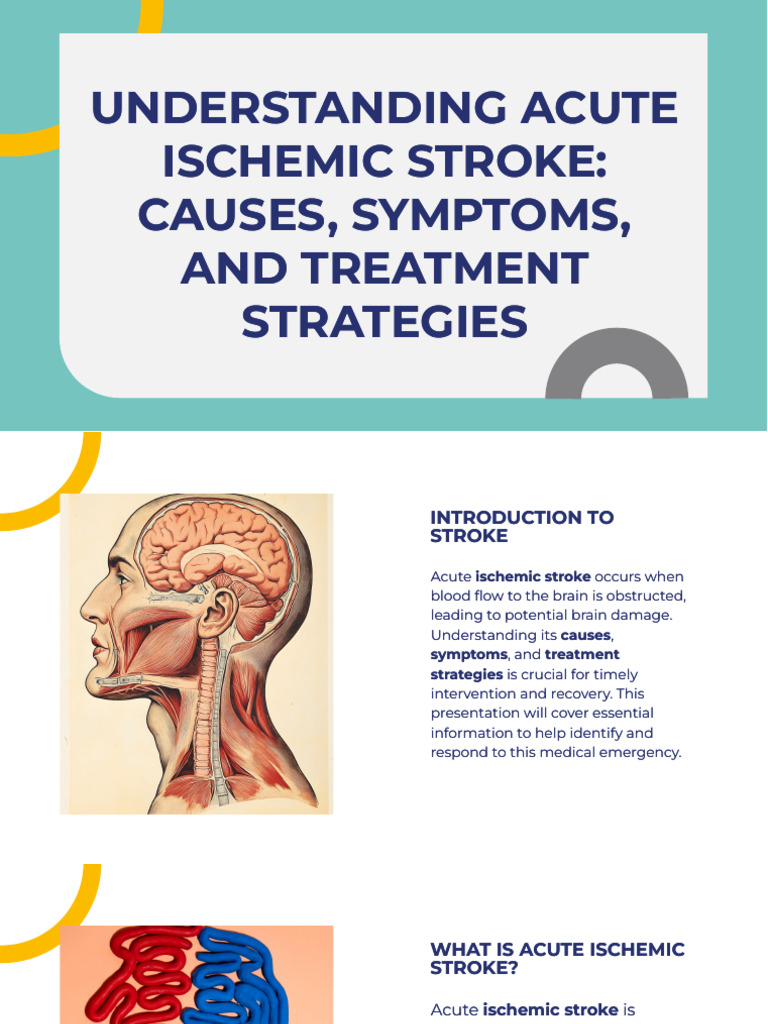 Slidesgo Understanding Acute Ischemic Stroke Causes Symptoms and ...