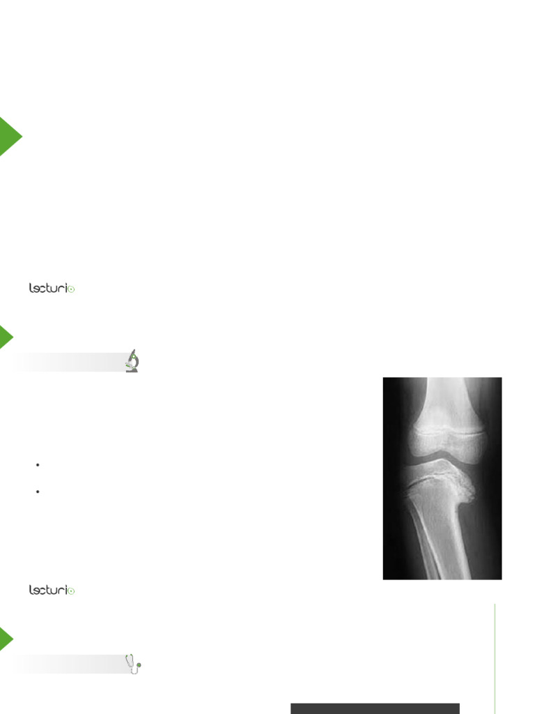 Pediatric Orthopedic Leg Problems: Rheumatology and Orthopedics With ...