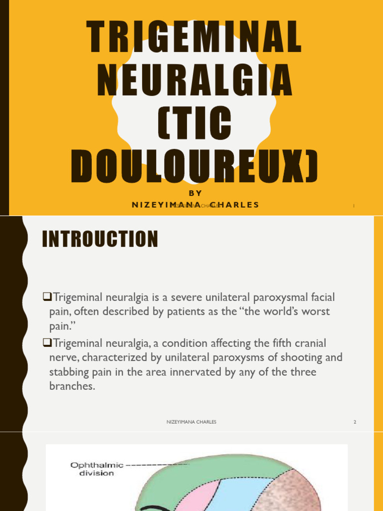 Trigeminal Neuralgia | PDF | Diseases And Disorders | Medical Specialties