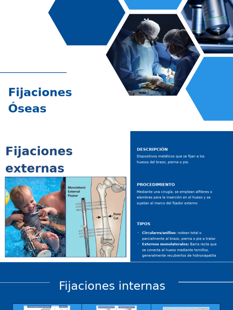 Fijaciones Óseas | PDF | Titanio | Acero