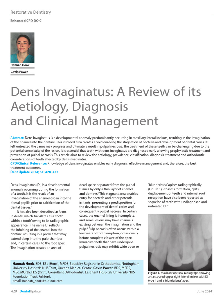 Dens Invaginatus: Diagnosis & Management | PDF | Human Tooth | Tooth Enamel
