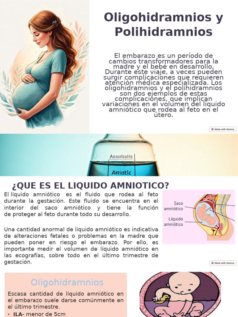 Oligohidramnios y Polihidramniosl | PDF | El embarazo | Feto