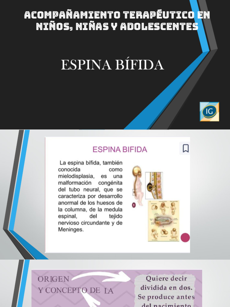 Espina bifida | PDF