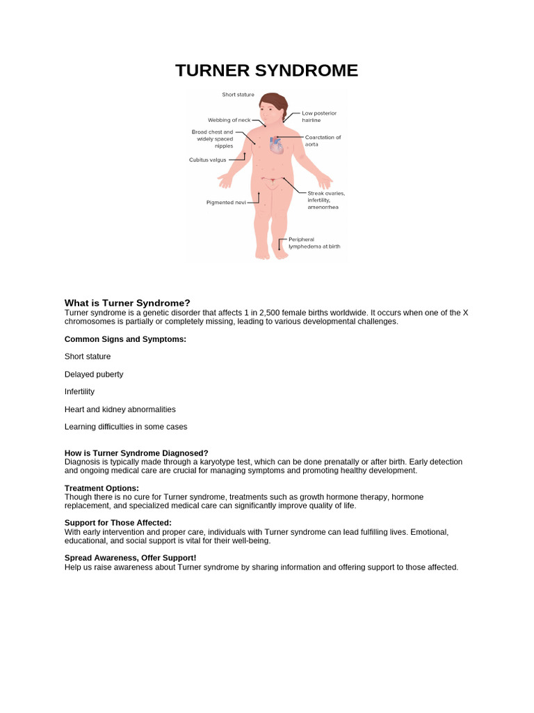 Turner Syndrome | PDF