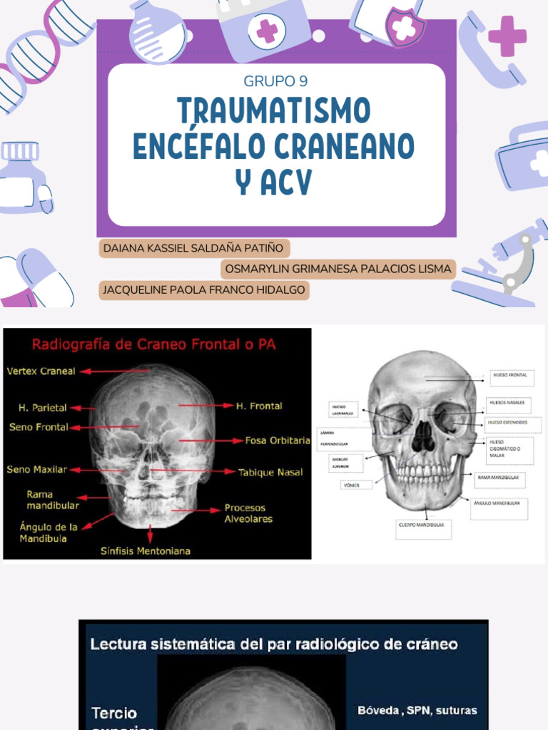 Tec, Acv | PDF | Carrera | Isquemia