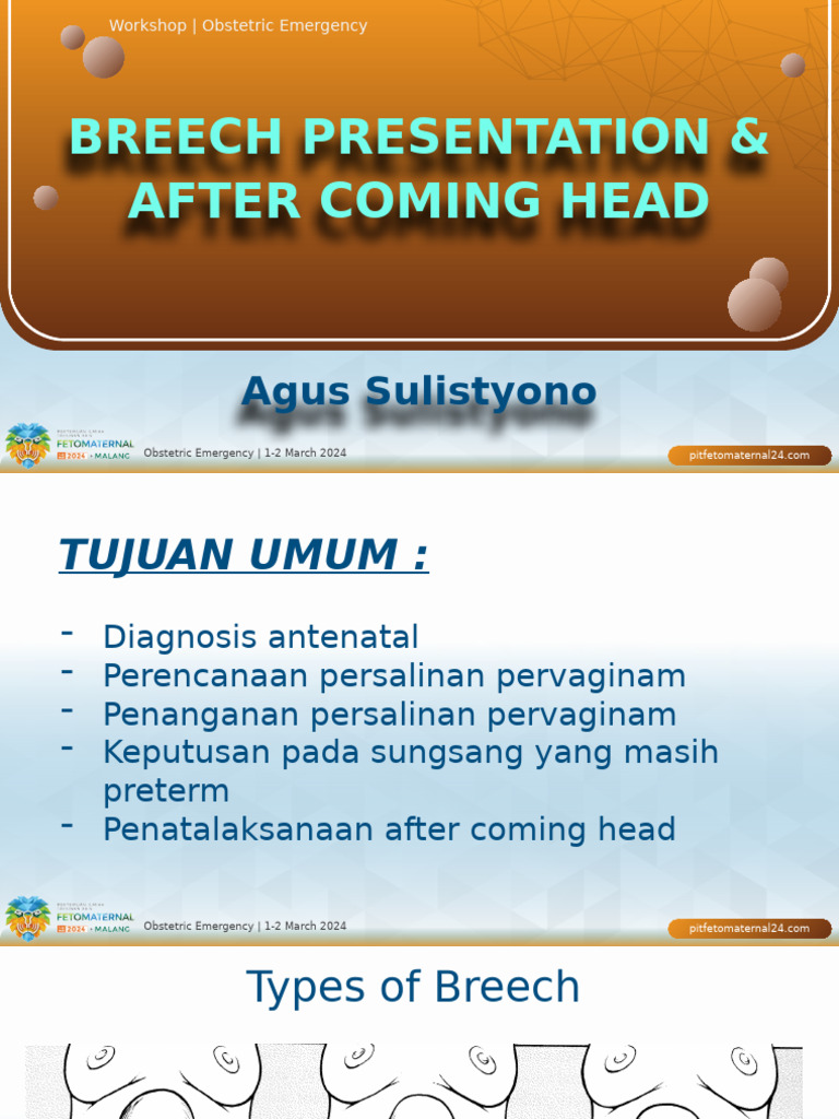 DR Agus Sulistyono, SpOG, Subsp KFM - Breech Presentation and After ...