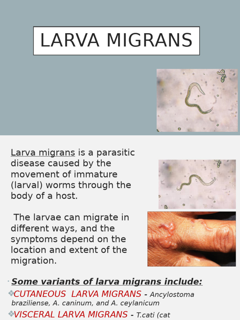 New larva migrans | PDF | Parasitology | Medical Specialties