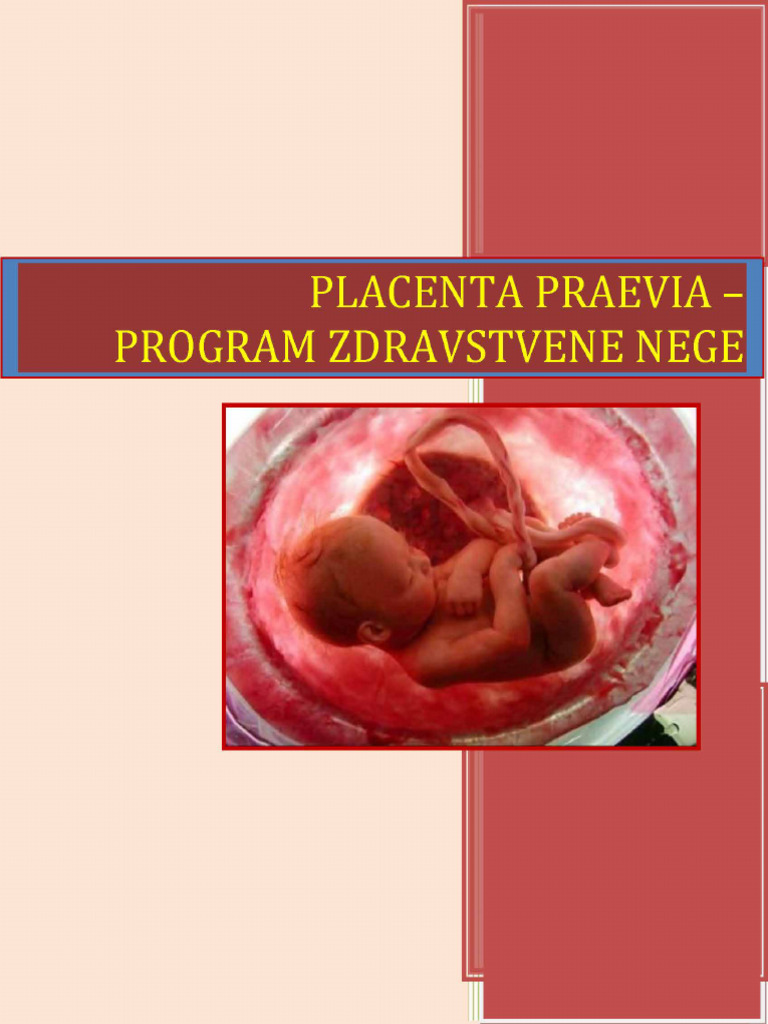 Placenta Praevia | PDF