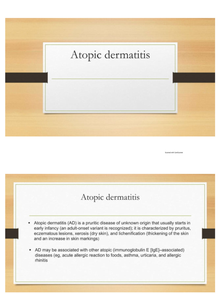Atopic Dermatitis | PDF