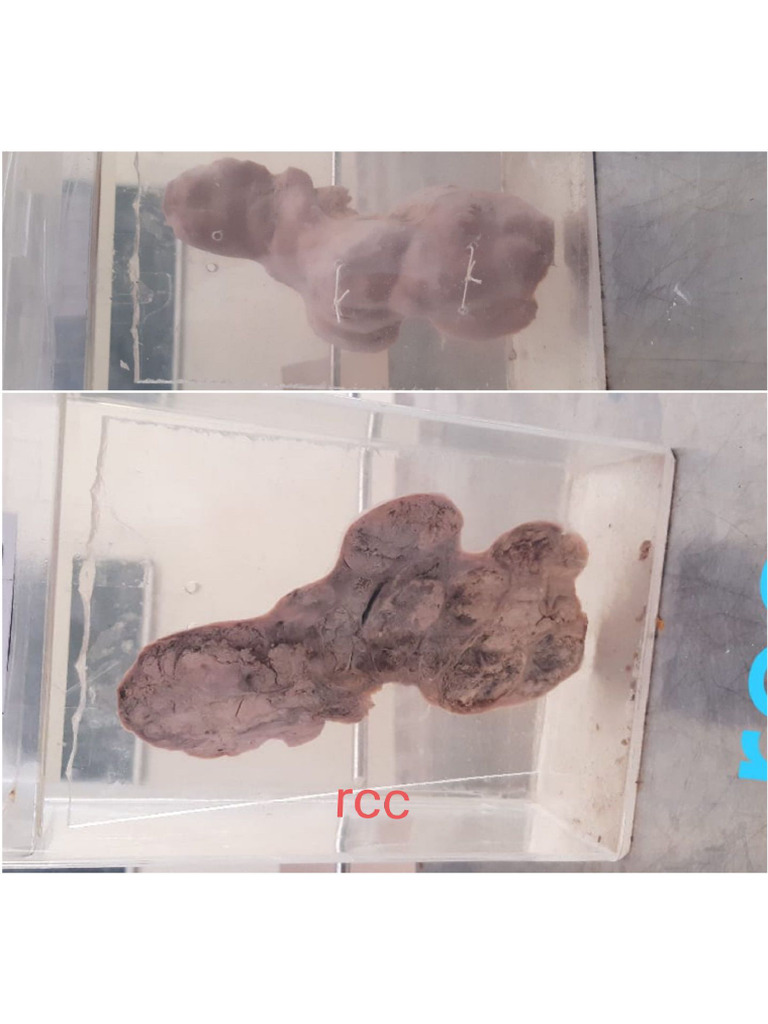 Pathology gross specimens | PDF