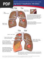 AJCC Lung Cancer Staging 9th Edition | PDF | Metastasis | Thorax (Human ...