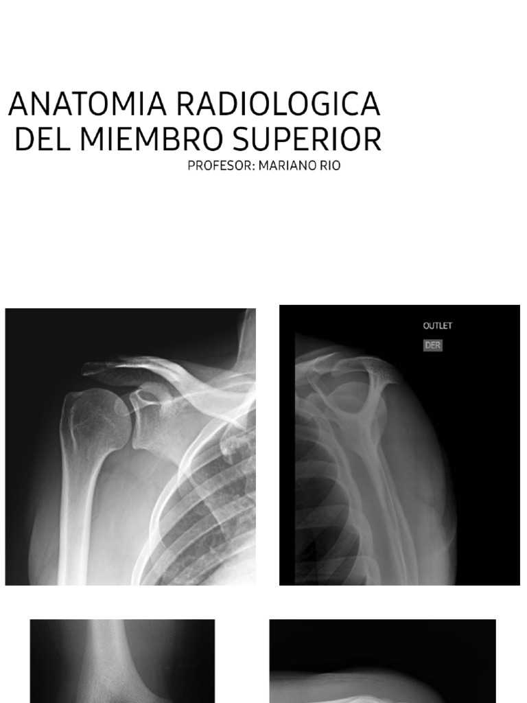 Anatomia Radiologica Del Miembro Superior | PDF