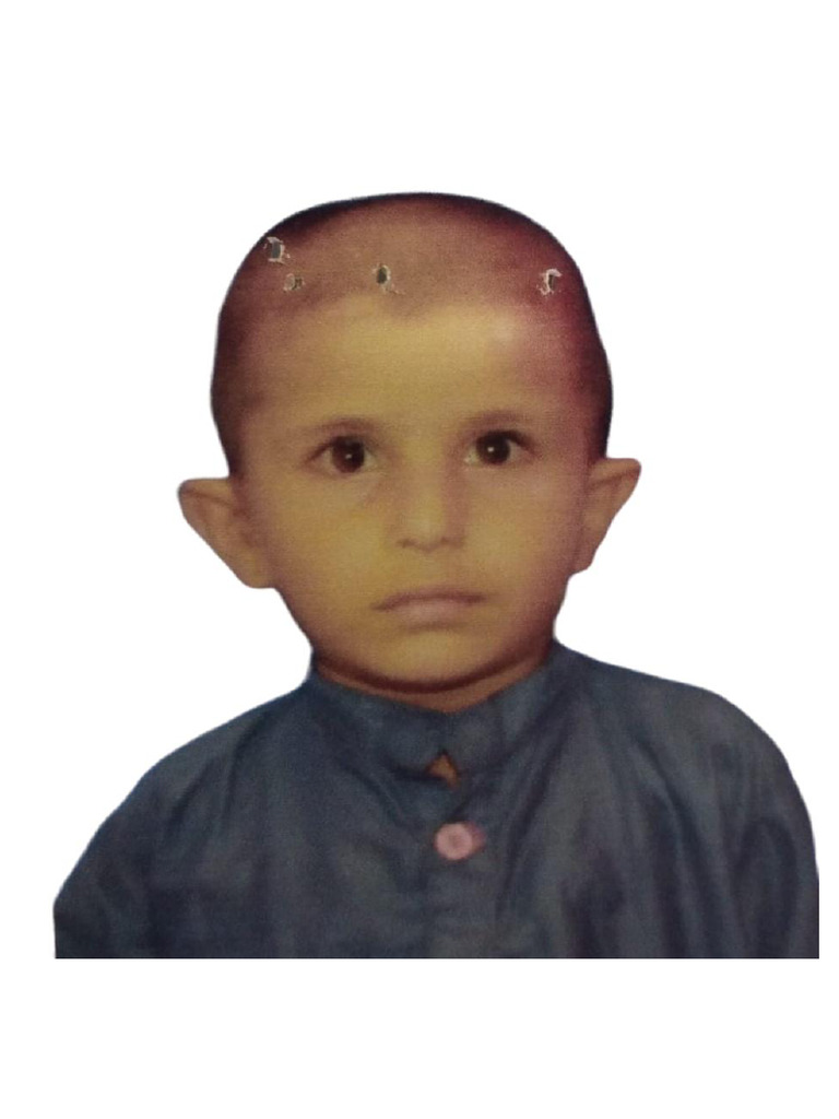 Pictorial PDF GR Sequence | PDF