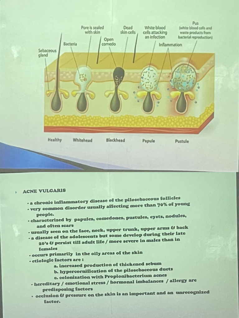 DRM09 Acne and Acneiform Disorders (12th September 2024) DR ML Tison ...