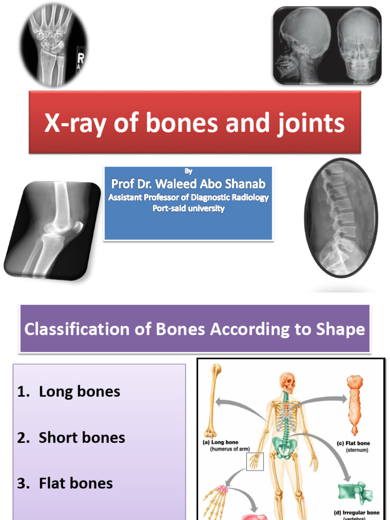 X-ray bones marked 1 | PDF | Bone | Joint
