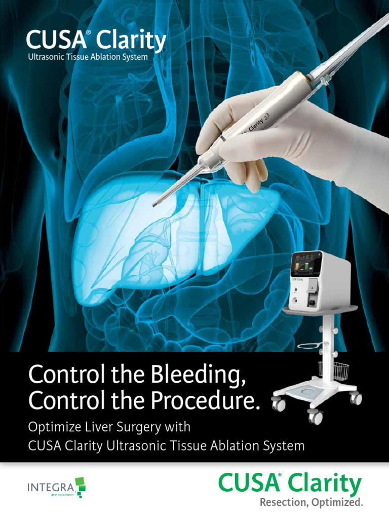 Cusa Clarity: Control The Bleeding, Control The Procedure | PDF ...