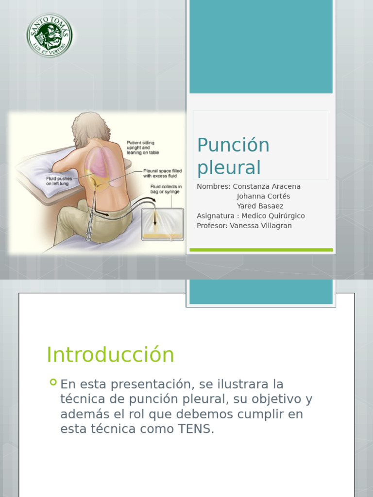 Técnica de Punción Pleural y Rol del TENS | PDF