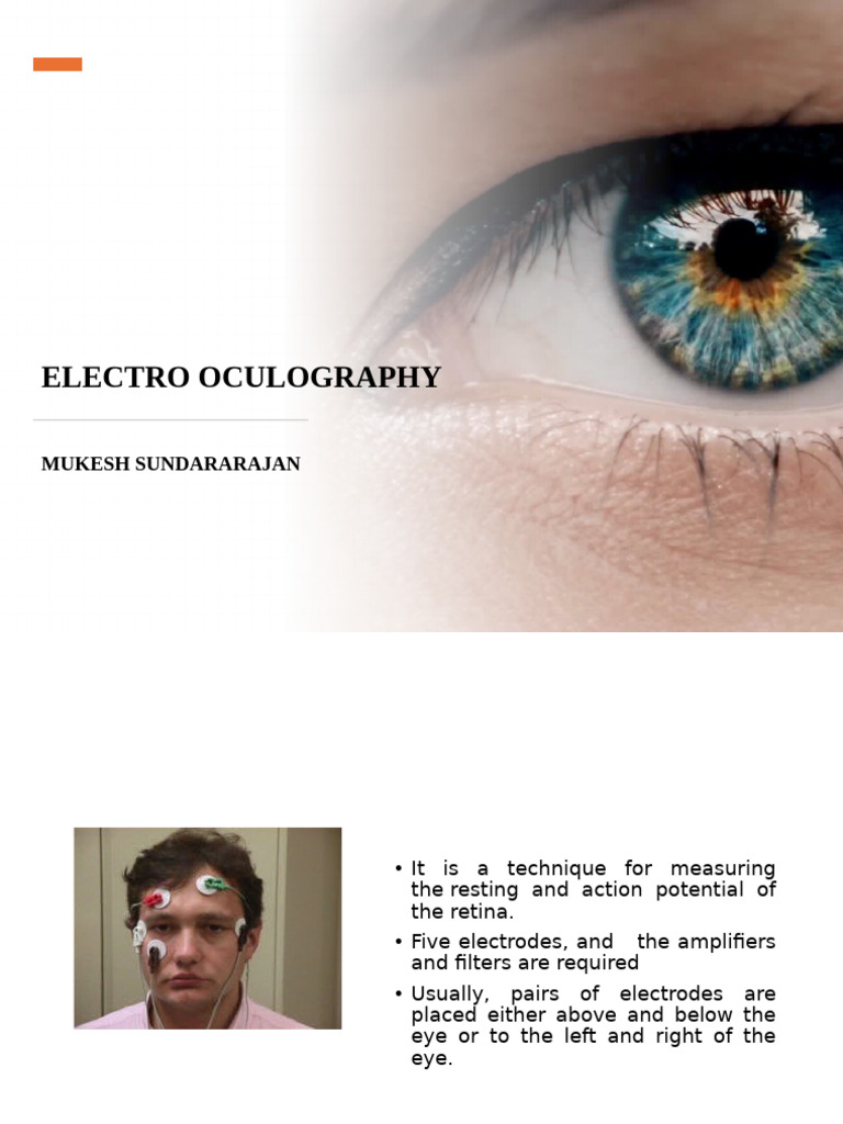 Electro Oculography - SSM | PDF | Eye | Electricity