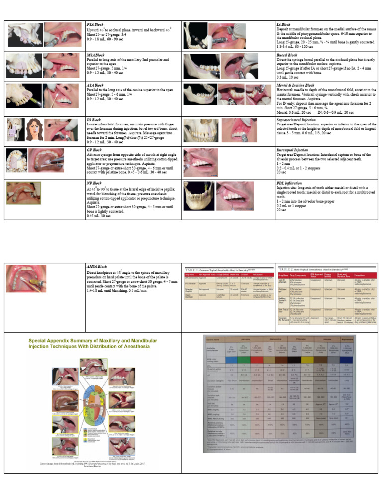 Local Anesthesia Blocks | PDF | Mouth | Dentistry Branches