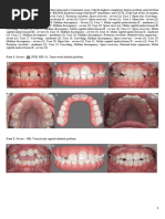 Periodontal Screening and Recording (PSR) System: Criteria For ...