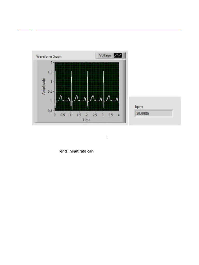 1 Simple ECG Circuit and LabVIEW Heart Rate Program - 6 Steps | PDF ...