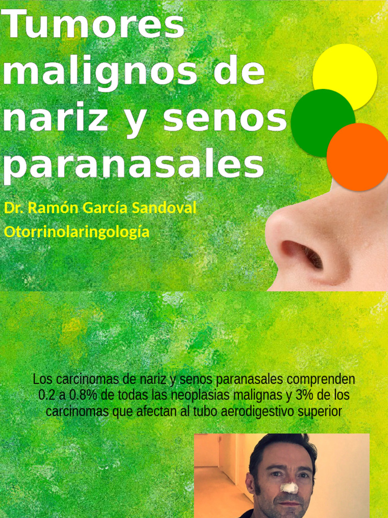 Tumores Malignos de Nariz y Senos Paranasales | PDF | Neoplasias | Adenocarcinoma