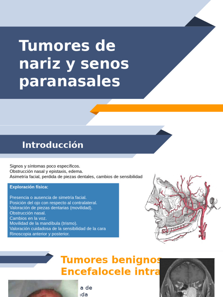 Tumores de SPN | PDF | Neoplasias | Medicina CLINICA