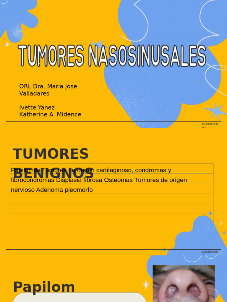 Tumores Nasales | PDF | Neoplasias | Metástasis