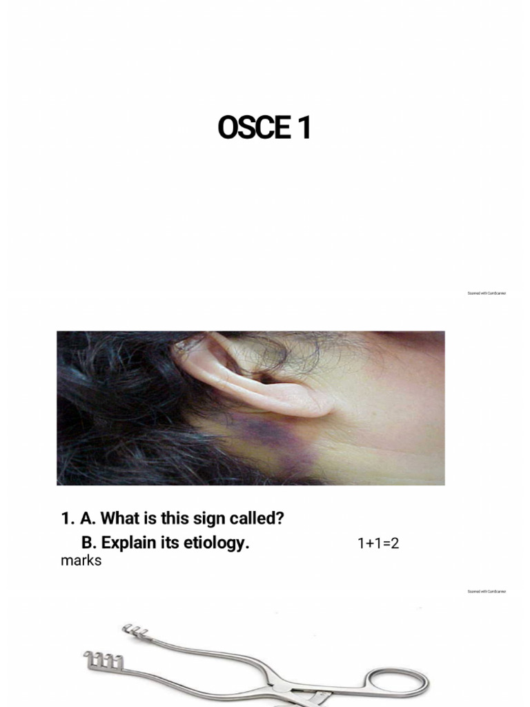 Extra OSCE Ent | PDF