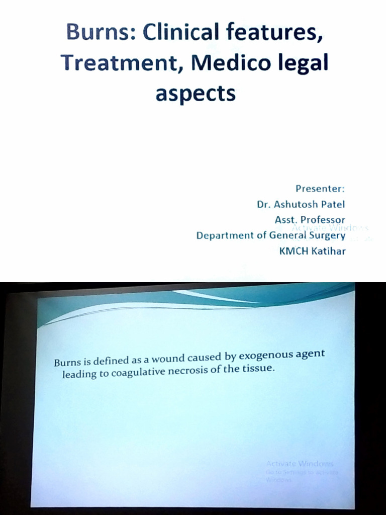 Burn (Surgery) 24 Jun 2023 | PDF