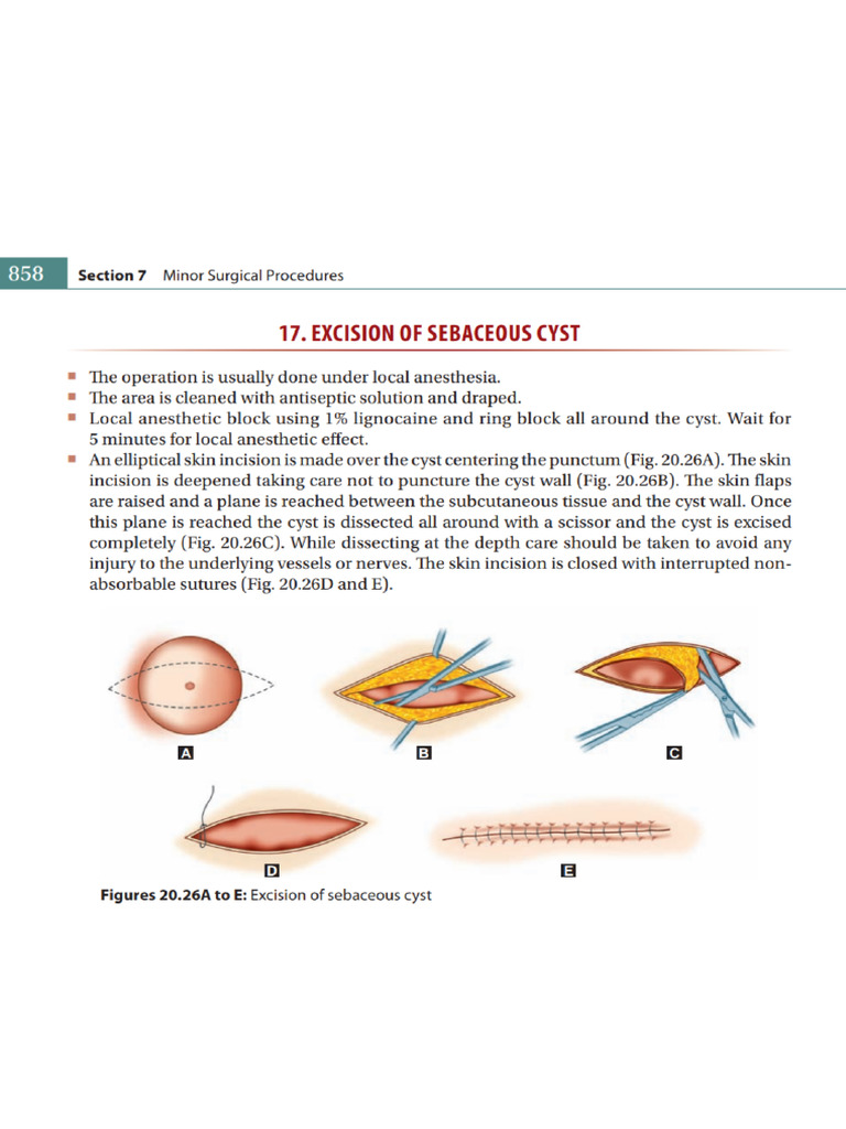 Surgery Procedures | PDF