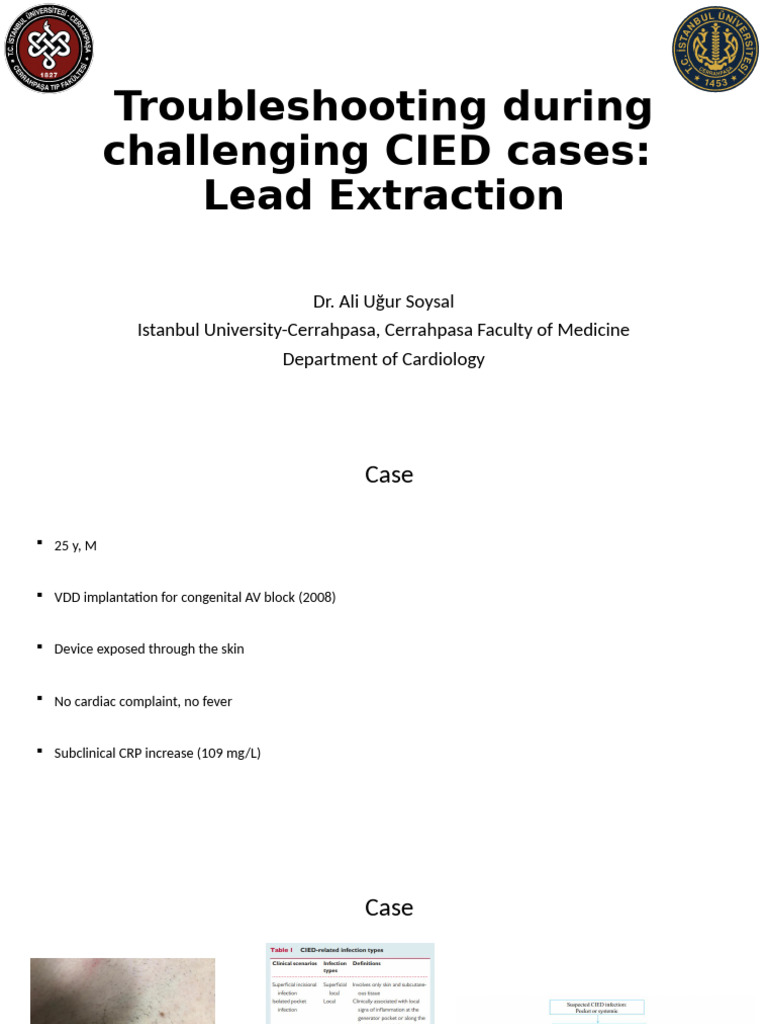 CIED Lead Extraction Challenges | PDF