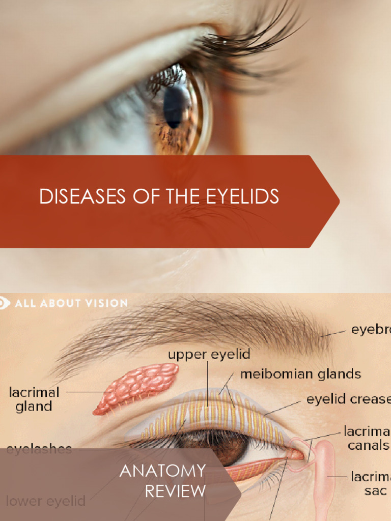 Eyelid Diseases: Symptoms and Treatments | PDF | Human Eye | Ophthalmology